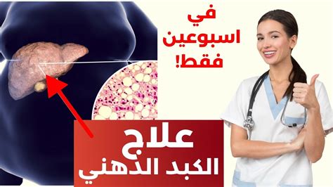 ودع الكبد الدهني للأبد المعلومات الضرورية لمرضى السكر، السمنة وضغط