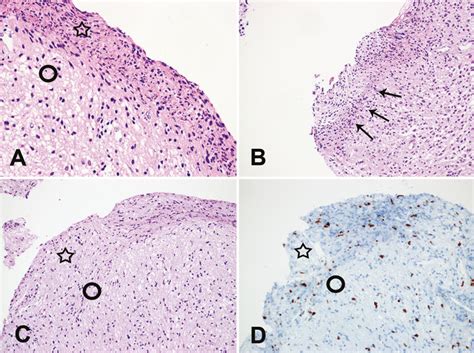 High Power View Of The Compressing Artifacts The Area Of The Download Scientific Diagram