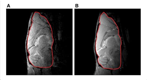 Mouse Brain Gradient Echo Images Acquired At 94 T With A Rt Download Scientific Diagram