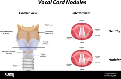 Types Of Vocal Cords And Their Functions At William Behm Blog