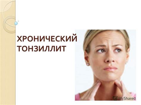 Презентация на тему ХРОНИЧЕСКИЙ ТОНЗИЛЛИТ Хронический тонзиллит