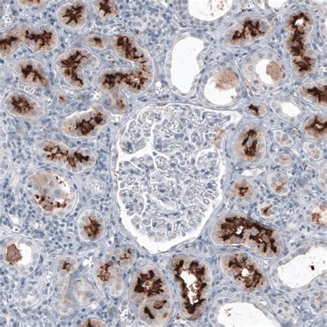 Ace2 Monoclonal Antibody Cl4013 Invitrogen 100 μl Unconjugated