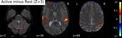Nistats Functional Mri In Python — Functional Mri For Neuroimaging