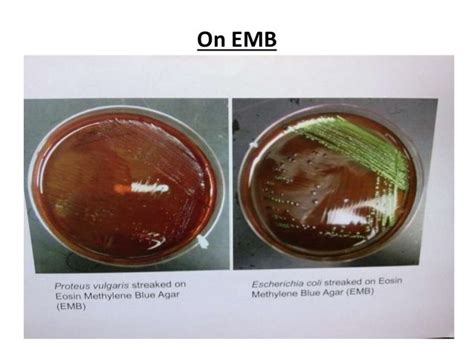 Proteus Bacteria Morphology