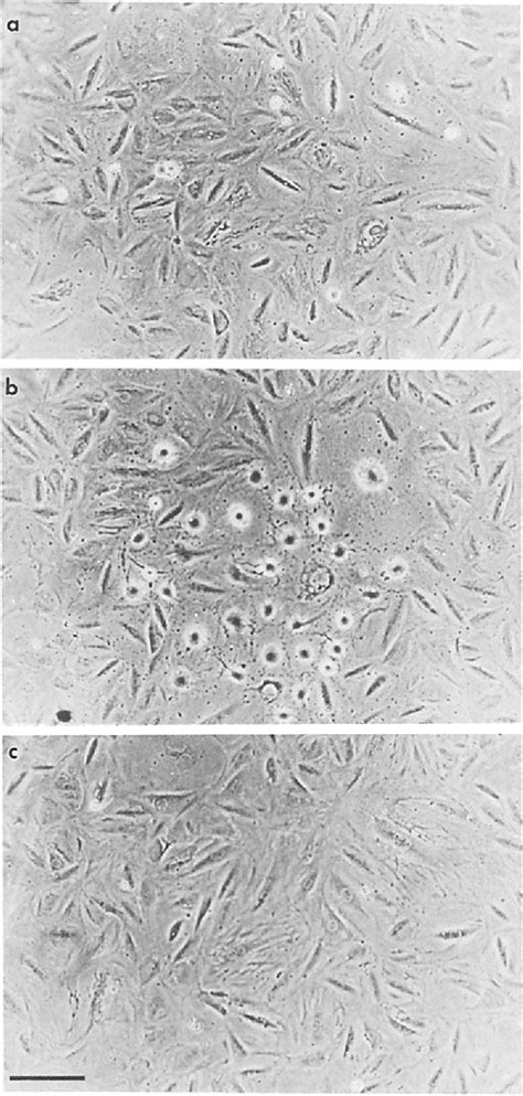 Figure 3 From Regulation Of Actin Microfilament Integrity In Living