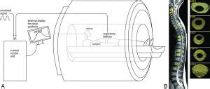 Cerebrospinal Flow Dynamics Multiscale Flow Physics