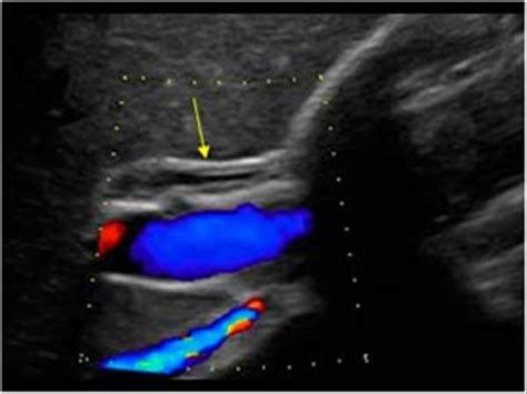 Abdomen And Retroperitoneum 1 2 Gallbladder And Bile Ducts Case 1 2