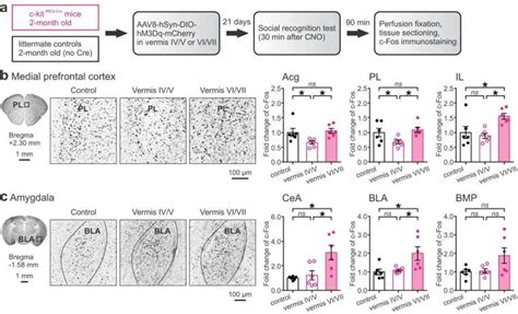 Research Team Discovers New Role Of Cerebellum In Coordinating The Brain Network Essential For