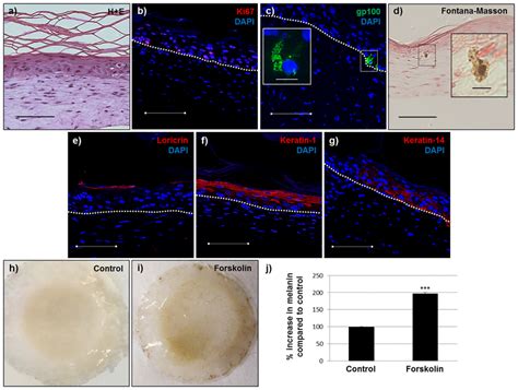 3D Skin Equivalents Produced From IPSC Derived Fibroblasts