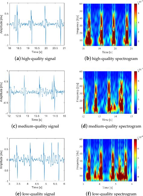 Figure 1 From Unsupervised Learning Based Non Invasive Fetal Ecg Muti Level Signal Quality