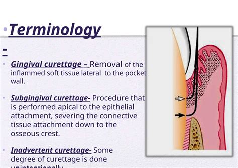 Gingival Surgical Techniques Dr Deepthipptx Gingival Surgical Techniques Dr Deepthipptx