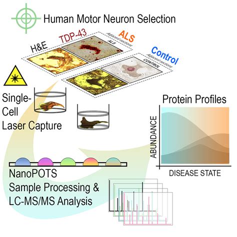 Tdp 43 Stratified Single Cell Proteomics Of Postmortem Human Spinal