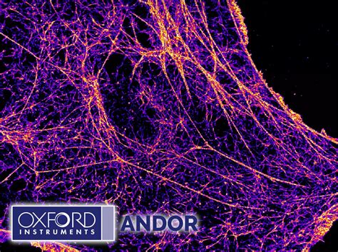 Andor High Speed Confocal With 3d Super Resolution