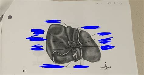 Hepatobiliary Diagram Part 3 Diagram Quizlet