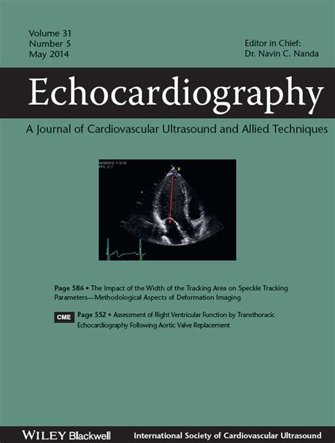 Cardiac Sarcoid A Chameleon Masquerading As Hypertrophic