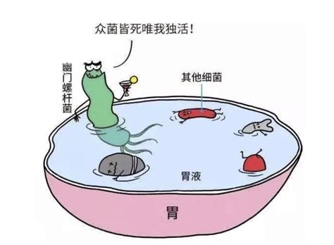 胃食管反流病合并幽门杆菌感染，需要根除治疗吗