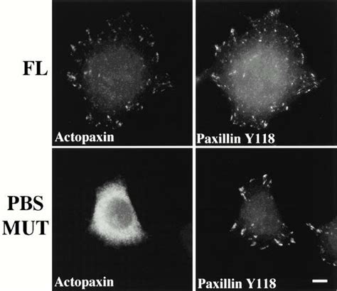 Ectopic Expression Of Wild Type Full Length Actopaxin Or Actopaxin Pbs