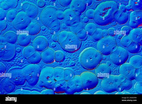Lysine Crystals Polarized Light Micrograph Of Crystals Of Lysine An Essential Amino Acid That