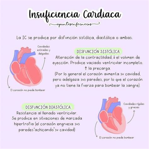 Insuficiencia Cardíaca Yudocorg Udocz