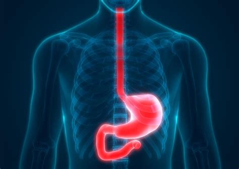 Reflux Gastro Sophagien Rebelle Penser L Sophagite Osinophile