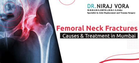 Femoral Neck Fractures Causes And Treatment In Mumbai Dr Niraj Vora