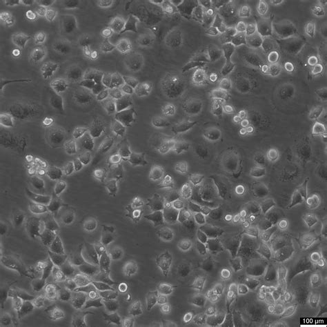 Cellules Nci H23