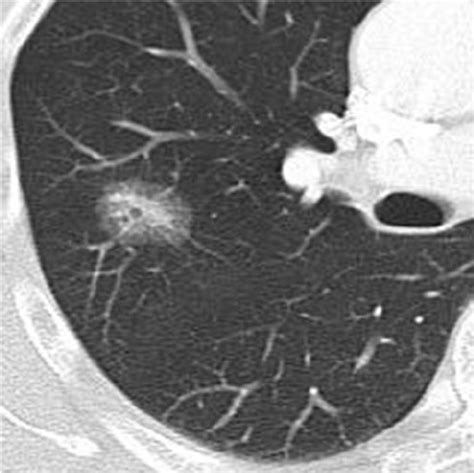 A B A Central Left Upper Download Scientific Diagram