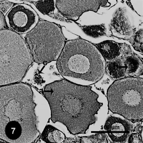 Ovary Structure In Deltamethrin Treated Group At The End Of 7 Days A