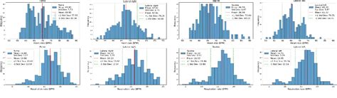 Figure 9 From In Home Smart Sleep Monitoring System For Cardiorespiratory Estimation And Sleep