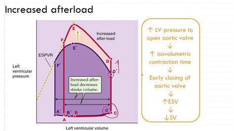 Physiological Variations Increased Afterload Youtube