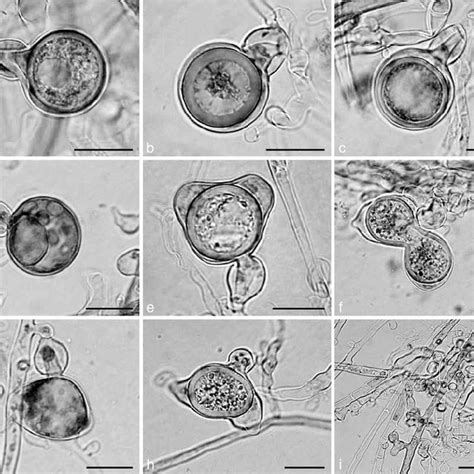 Phytophthora Capensis A E Mature Oogonia Thick Walled Round