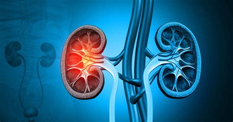 Omics And Immunoglobulin A Nephropathy Aimed Analytics