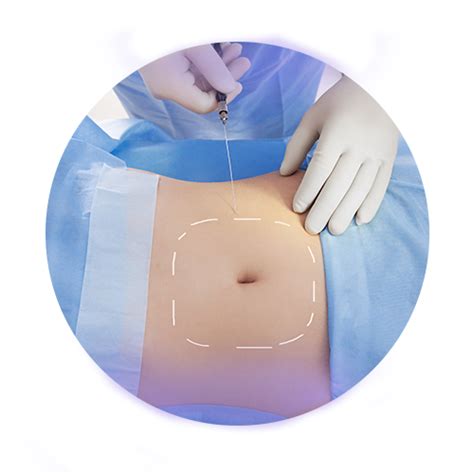 Vaser Liposuction Treatment Method Dmax Health