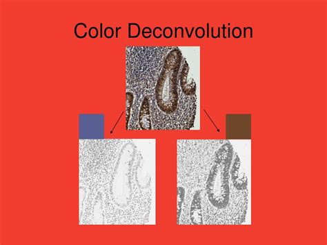 Ppt Can Color Detect Cancer Powerpoint Presentation Free Download