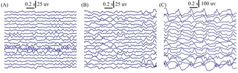 Entropy Free Full Text Using Permutation Entropy To Measure The