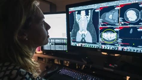 Pancreatic Cancer Predictor Ai Early Warning System Ivanhoe