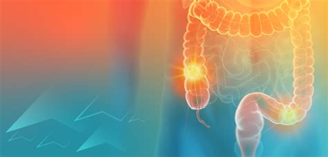 Pembrolizumab Combo Yields Enduring Activity In Advanced Non Clear Cell Rcc Cancernetwork