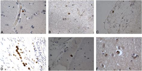 Neural Stem And Progenitor Cells And Proliferating Cells In