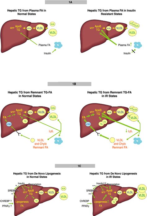 Figure 1 From Increased Very Low Density Lipoprotein Vldl Secretion