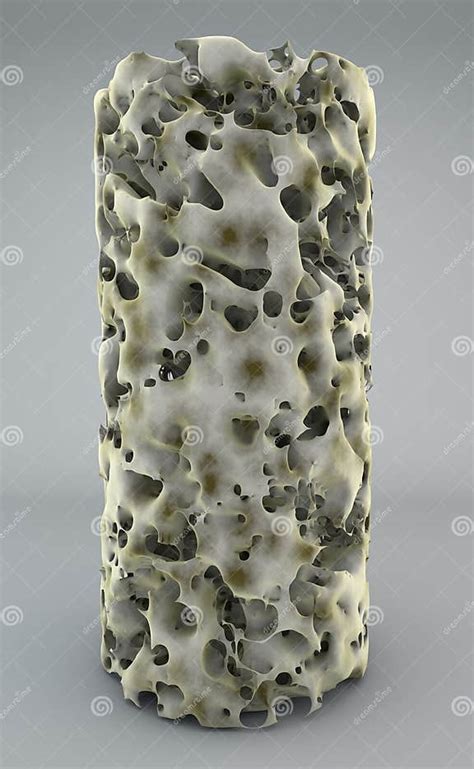 Section Of Bone With Osteoporosis Stock Illustration Illustration Of