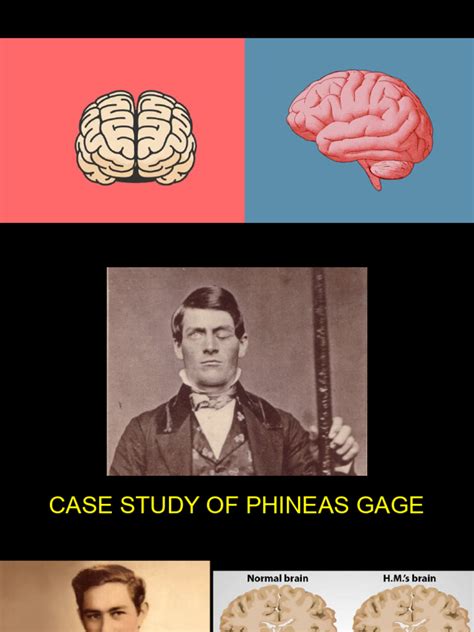 Neuroplasticity Theory Pdf