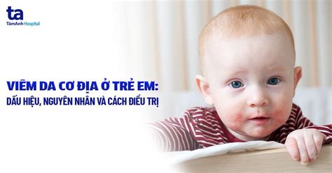 Viêm Da Cơ địa ở Trẻ Em