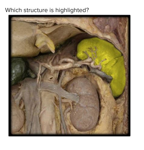Solved Iliac Nodes Cervical Nodes Inguinal Nodes Chegg