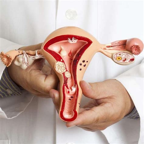 Ovarian Dysfunction Treatment