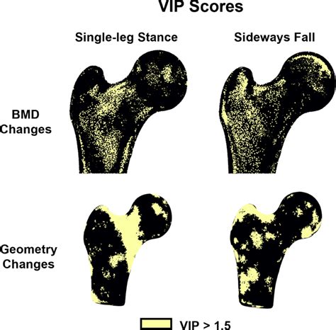 Variable Importance In Projection Vip Scores For The Bmd Only And