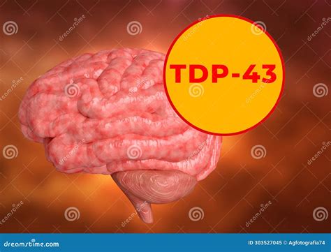 Tdp 43 Tar Dna Binding Protein 43 Is A Biochemical Marker Of