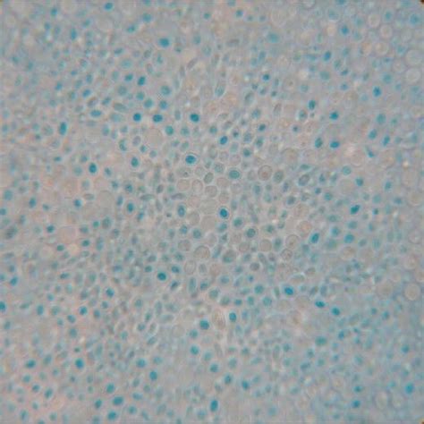 Lactophenol Cotton Blue Mount In 100x Download Scientific Diagram