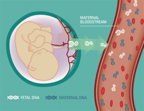 Nipt Faqs Sonic Genetics