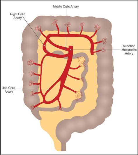 Mesenteric Artery Ischemia