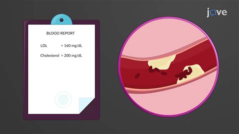 Video Cholesterol Significance And Regulation